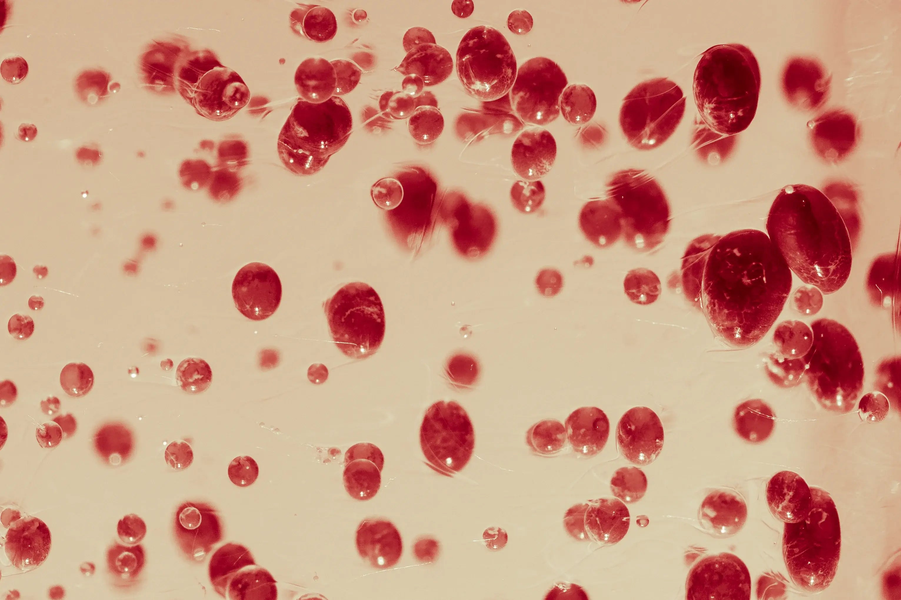 Descubre todo sobre el Ureaplasma (U. parvum y U. urealyticum): causas ...